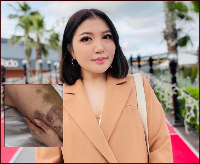 Цахим орчинд олноо танигдсан Дээгий бүсгүй сошиал инфлүзерүүд гоо сайхны хагалгаа сурталчилахдаа ...